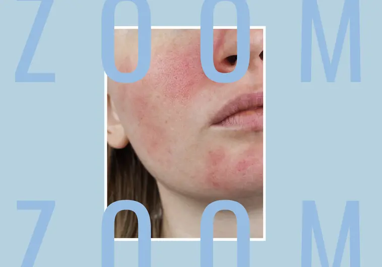 Anti-redness ranges - Products