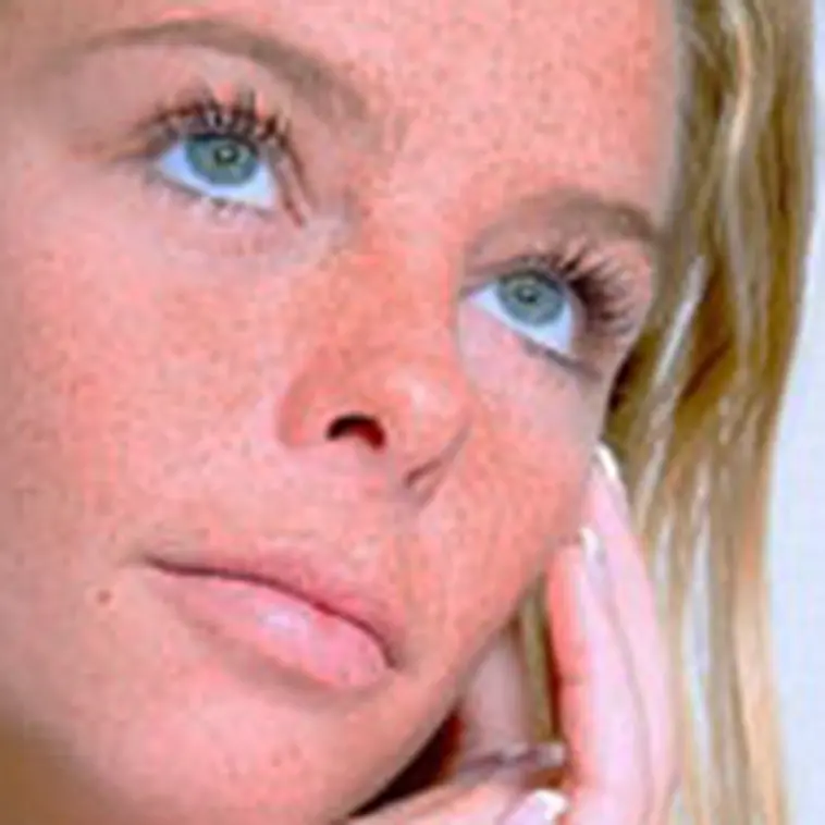 Preventing and treating benign summer lucitis - CosmeticOBS-L ...